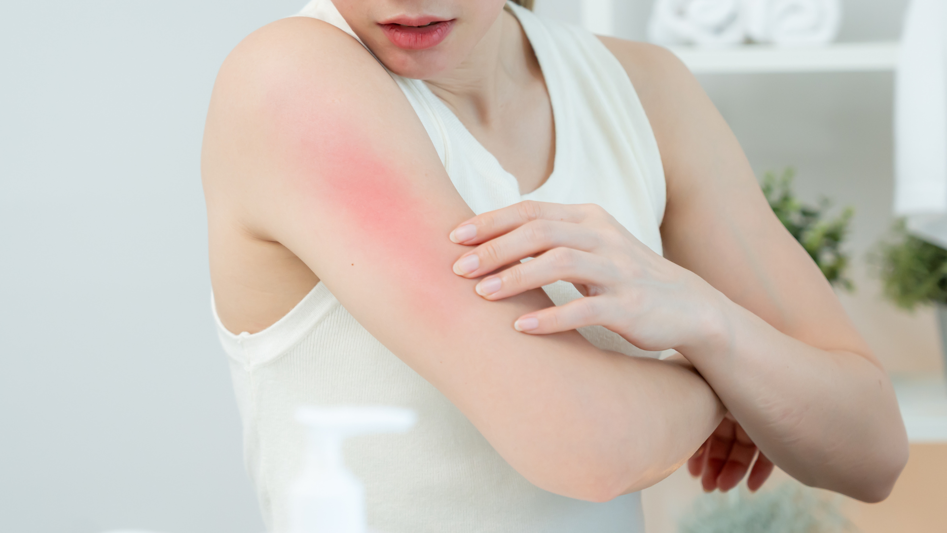 How to Combat Dry Skin and Rashes This Winter | Healthy Image | Dr ...